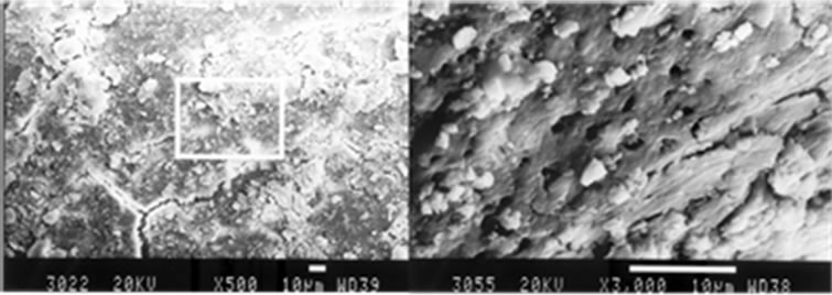 The cleaning efficiency of the root canal after different ...