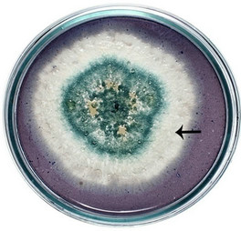 A novel strain of Trichoderma viride shows complete lignocellulolytic ...