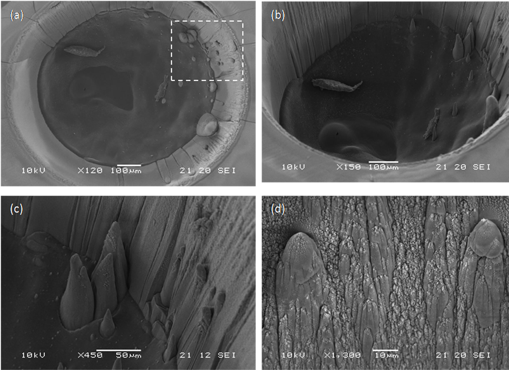 Conical Structures on Acrylic Intraocular Lens (IOLs) Materials after ...