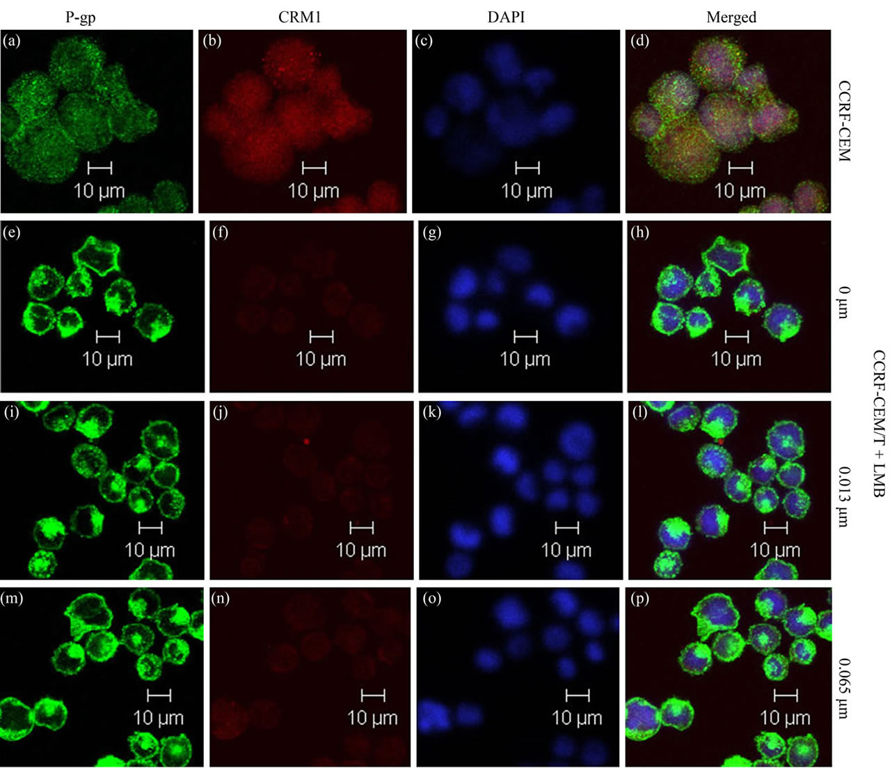 Cancerous multi-drug resistance is reduced by Leptomycin B treatment in ...