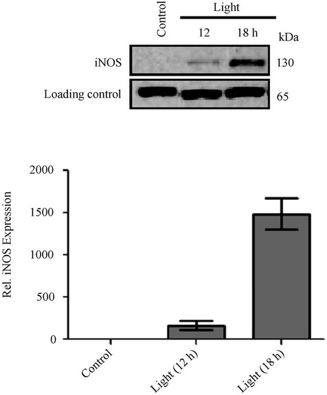 Nitric oxide leads to cytoskeletal reorganization in the retinal ...