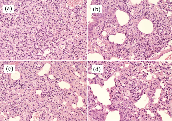 Telavancin in Experimental Murine Pneumococcal Pneumonia