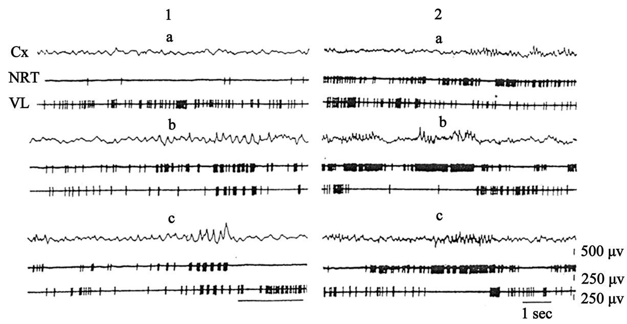Significance of the Thalamic Reticular Nucleus GABAergic Neurons in ...