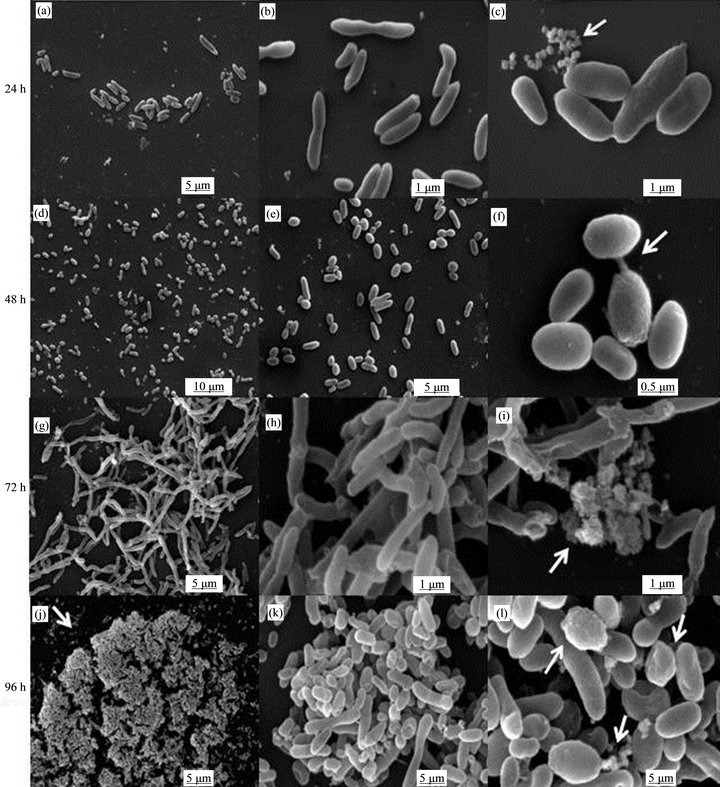 Evaluation of Morphological Changes of Aeromonas caviae Sch3 Biofilm ...