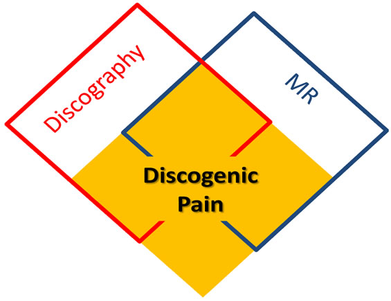 Discogenic pain: Who cares?