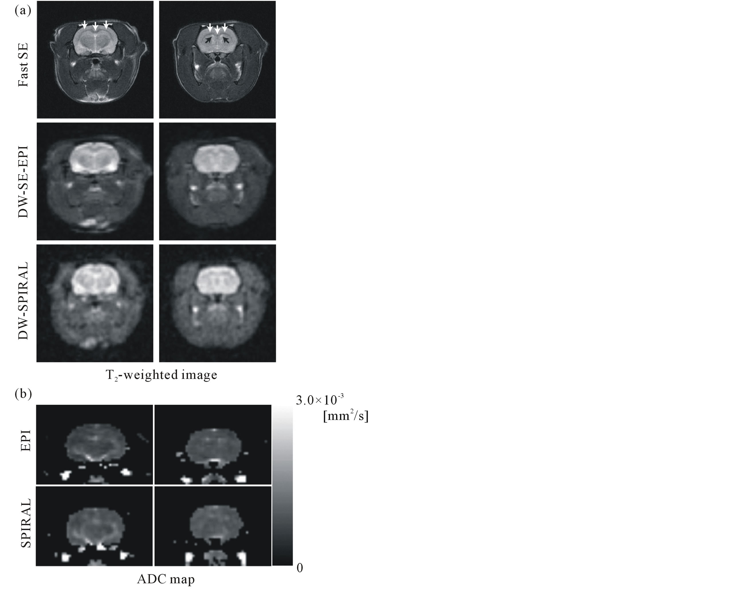 Apparent Diffusion Coefficient Mapping Using a Multi-Shot Spiral MRI ...