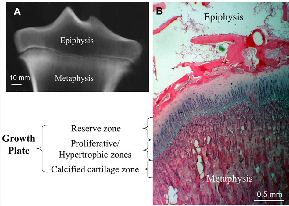 On the State of Stress in the Growth Plate under Physiologic ...