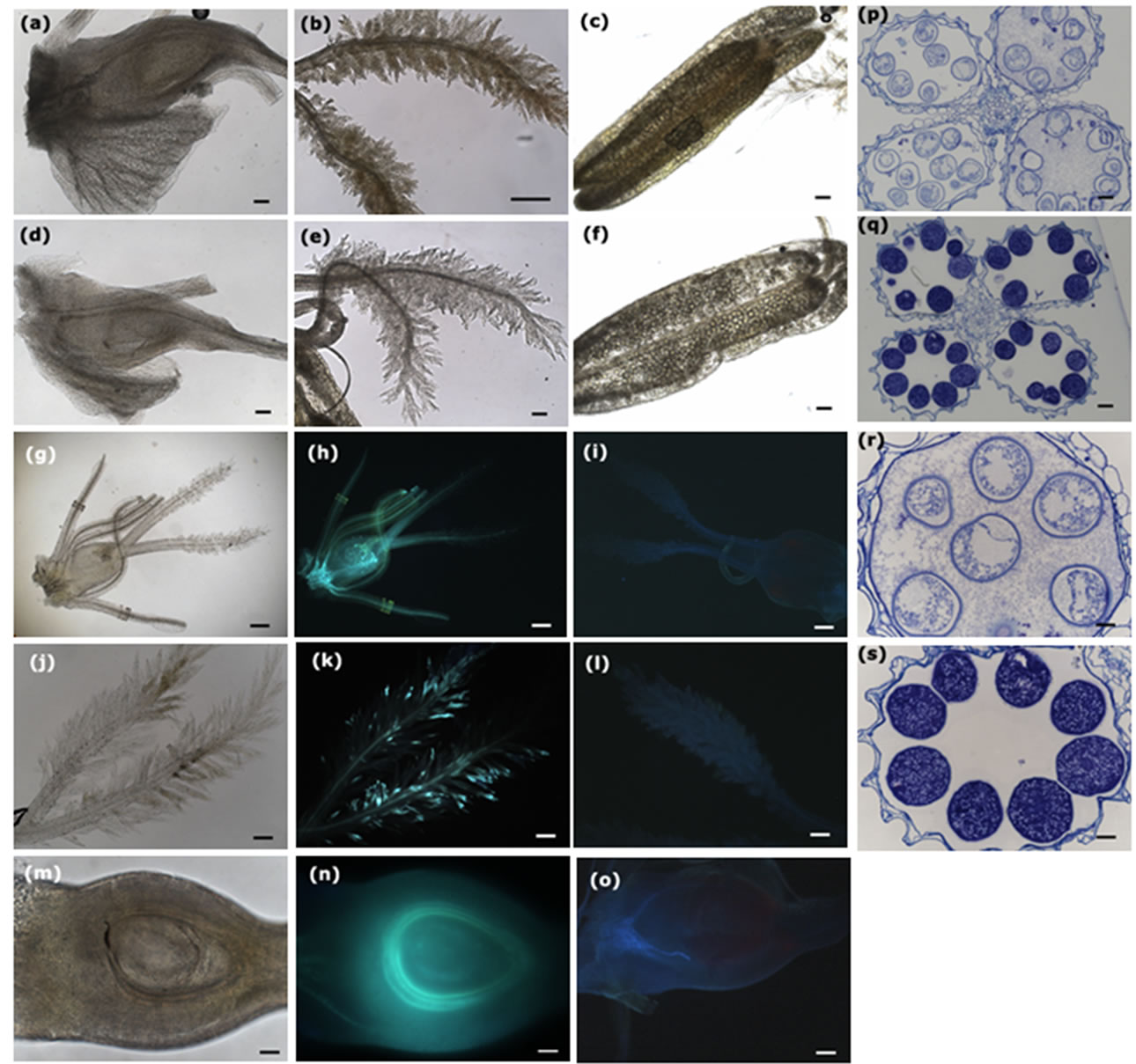 Rice False Smut Fungus, Ustilaginoidea virens , Inhibits Pollen ...