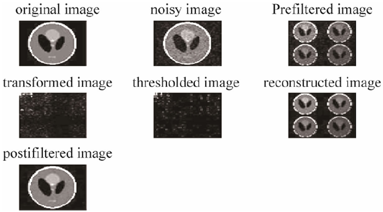 Denoising of Medical Images Using Multiwavelet Transforms and Various Thresholding Techniques