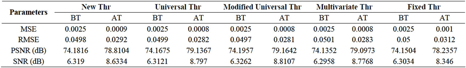 Denoising of Medical Images Using Multiwavelet Transforms and Various Thresholding Techniques
