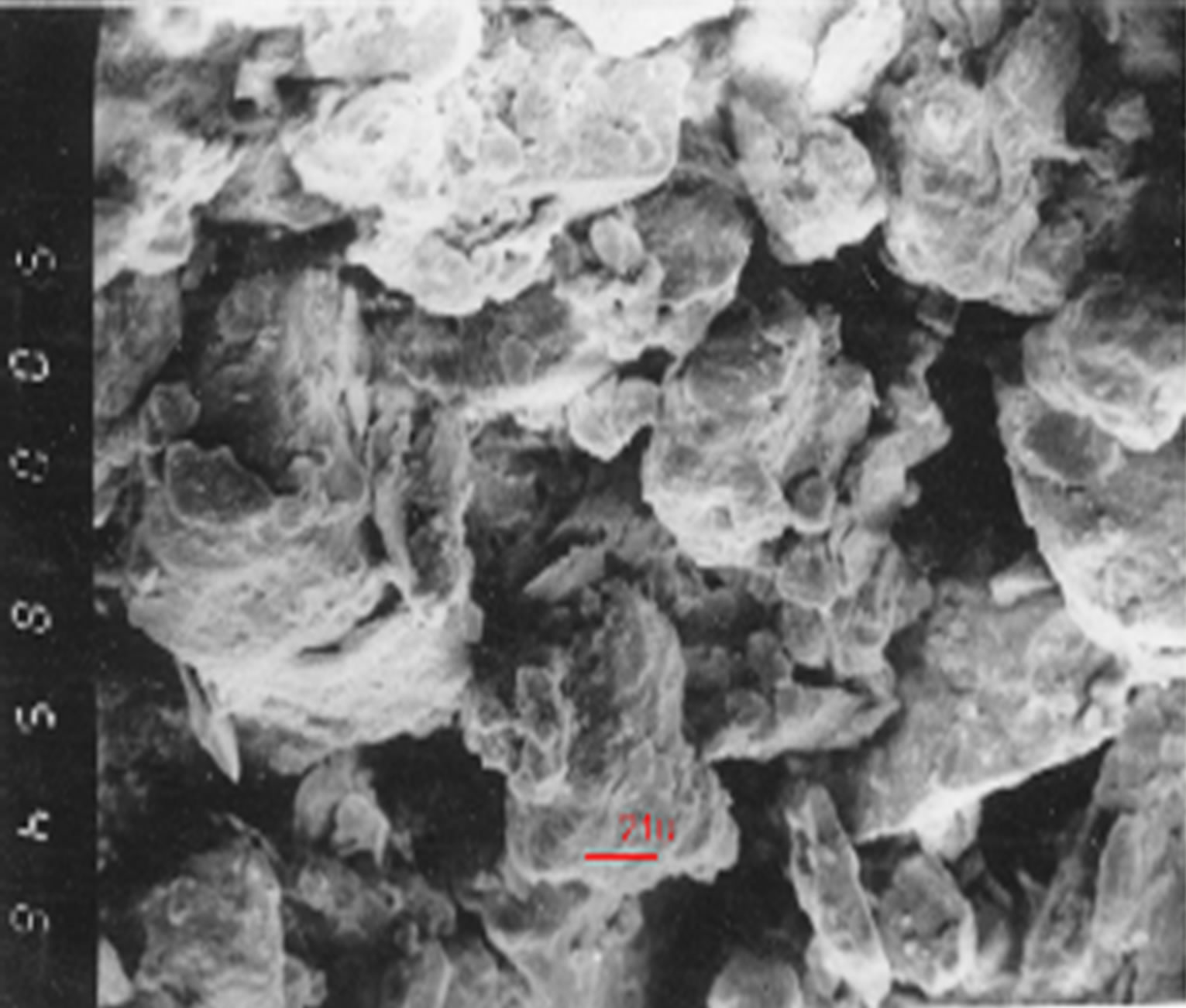 The loess microstructure kinds and its seismic subsidence