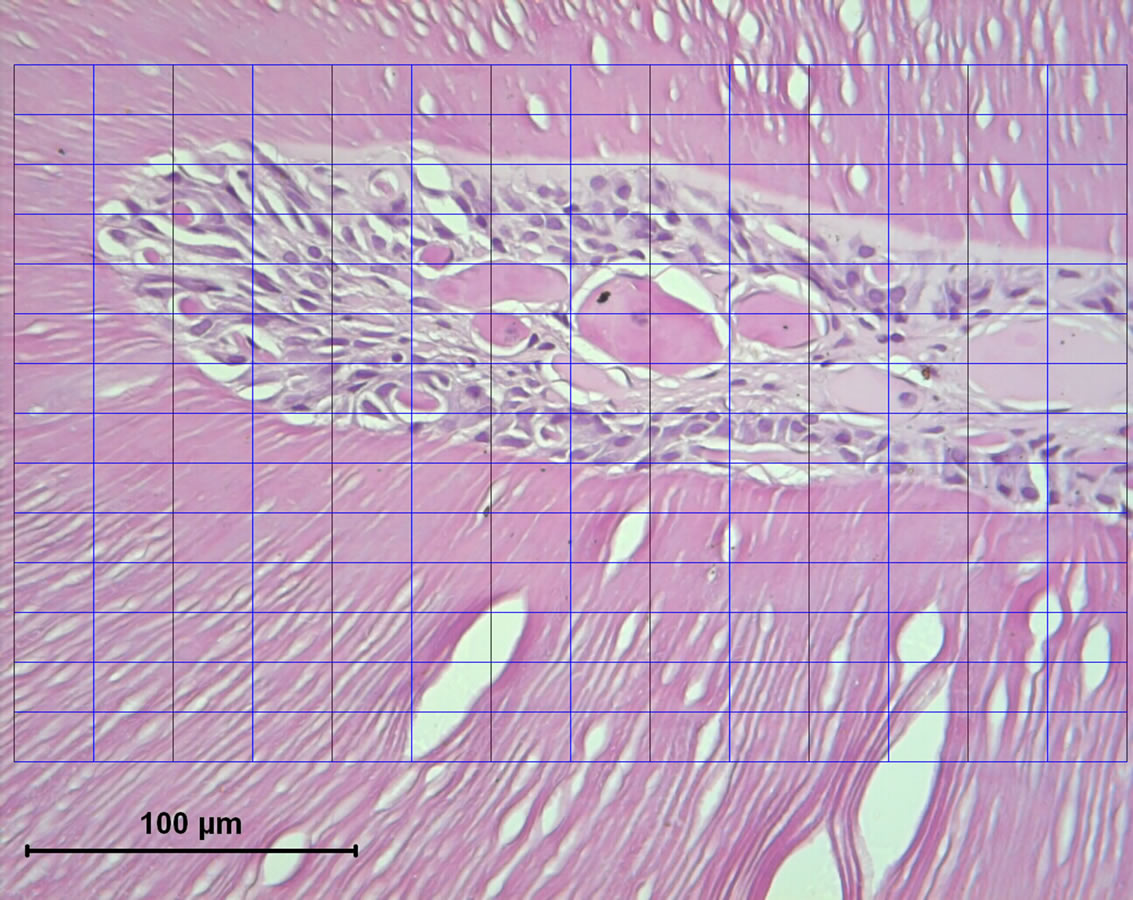The inflammatory response of the pulp after direct capping with ...