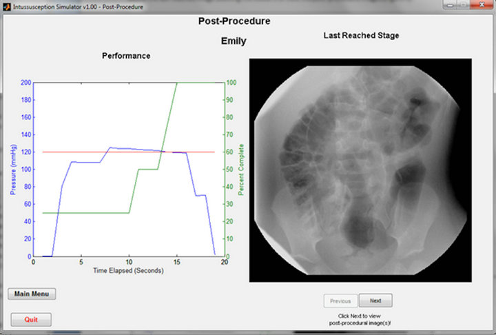 Improvements to a Novel Device Simulating Pneumatic Intussusception ...