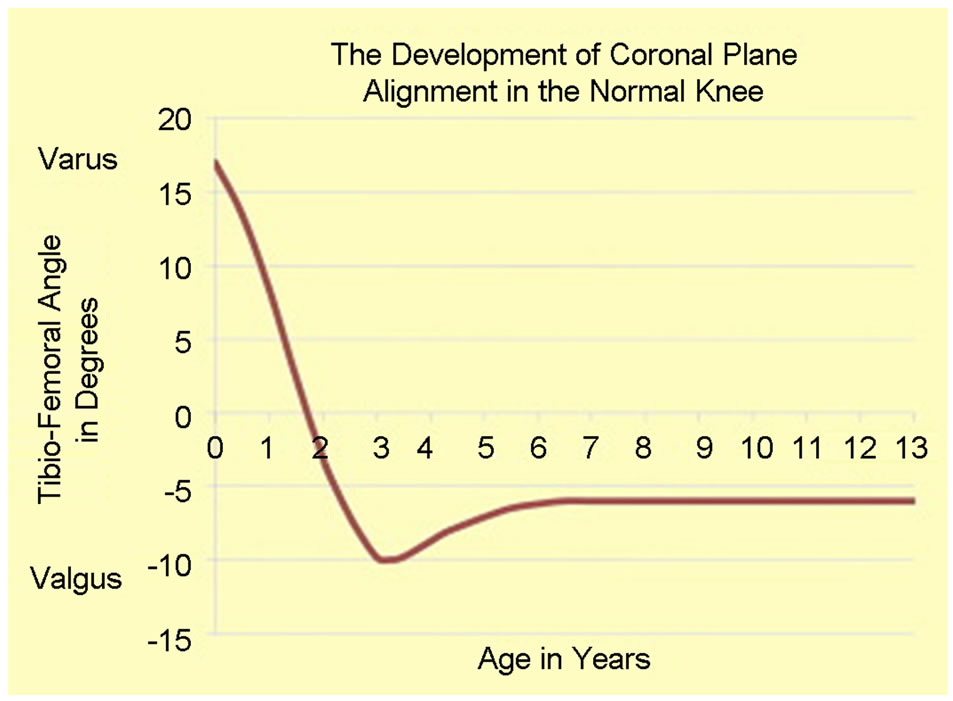 Normal Variants of the Lower Limbs in Pediatric Orthopedics