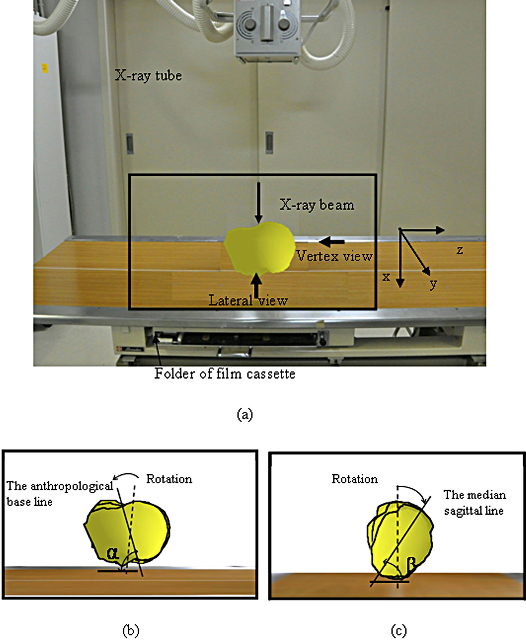 Positioning Training Tool for Radiography