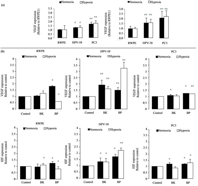 Polycyclic Aromatic Hydrocarbons May Contribute for Prostate Cancer ...