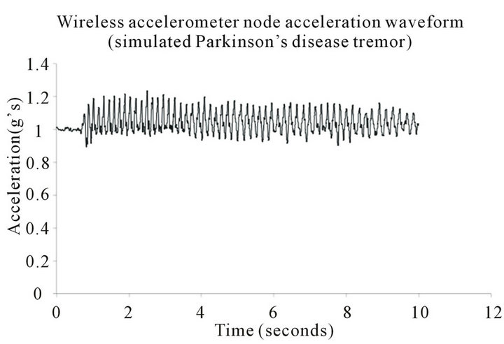 Wireless accelerometer configuration for monitoring Parkinson’s disease ...