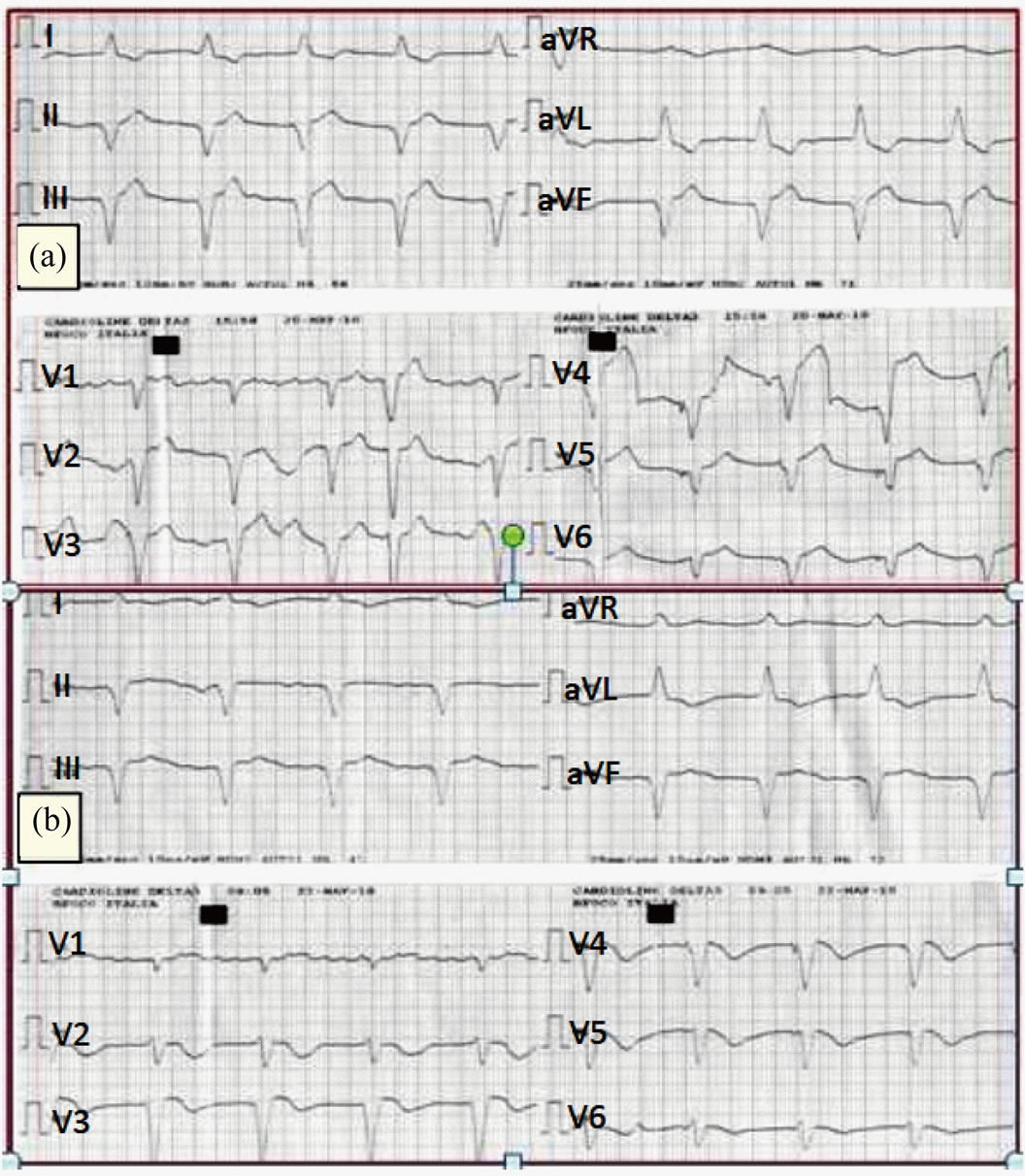 Tako-tsubo cardiomyopathy in a male patient after administration of ...