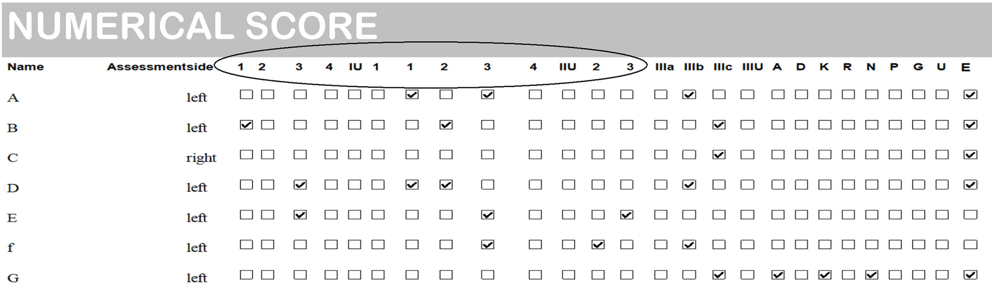 A Working Classification of Retraction for the Whole Tympanic Membrane
