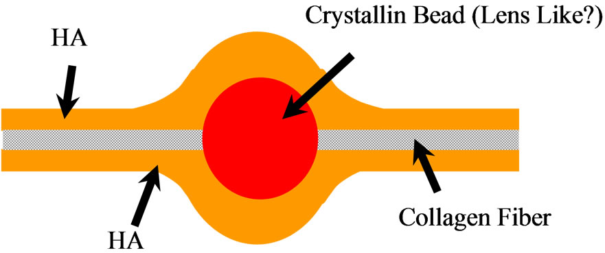 Structure of vitreous body and its relationship with liquefaction