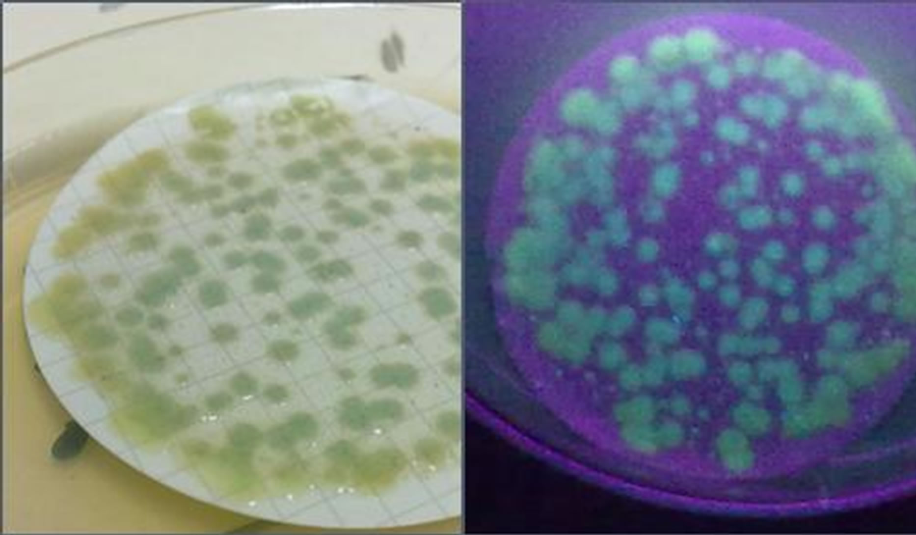 Non-Fermentative Gram-Negative Bacteria in Drinking Water