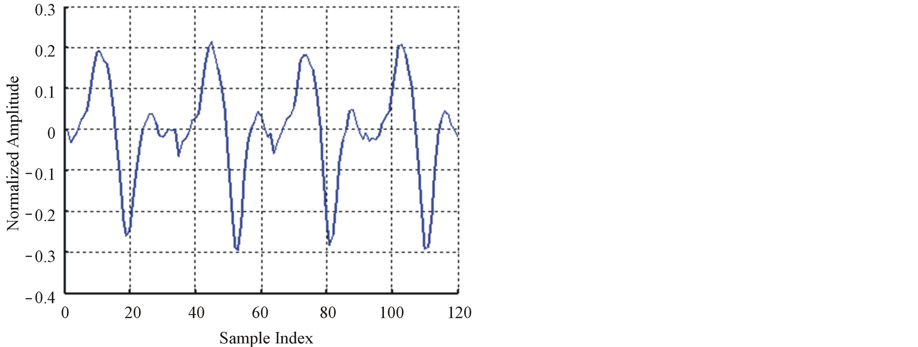 Compression Of Ecg Signals Based On Dwt And Exploiting The Correlation Between Ecg Signal Samples