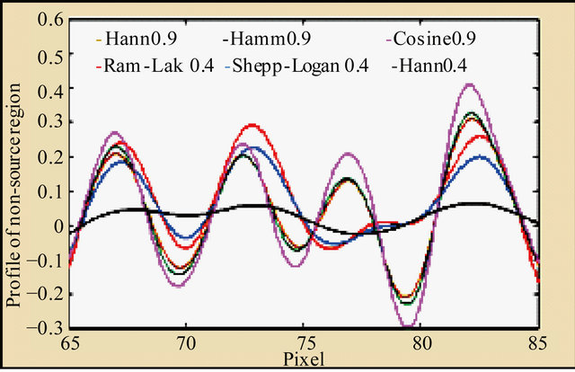 The influence of filters on the SPECT image of Carlson phantom