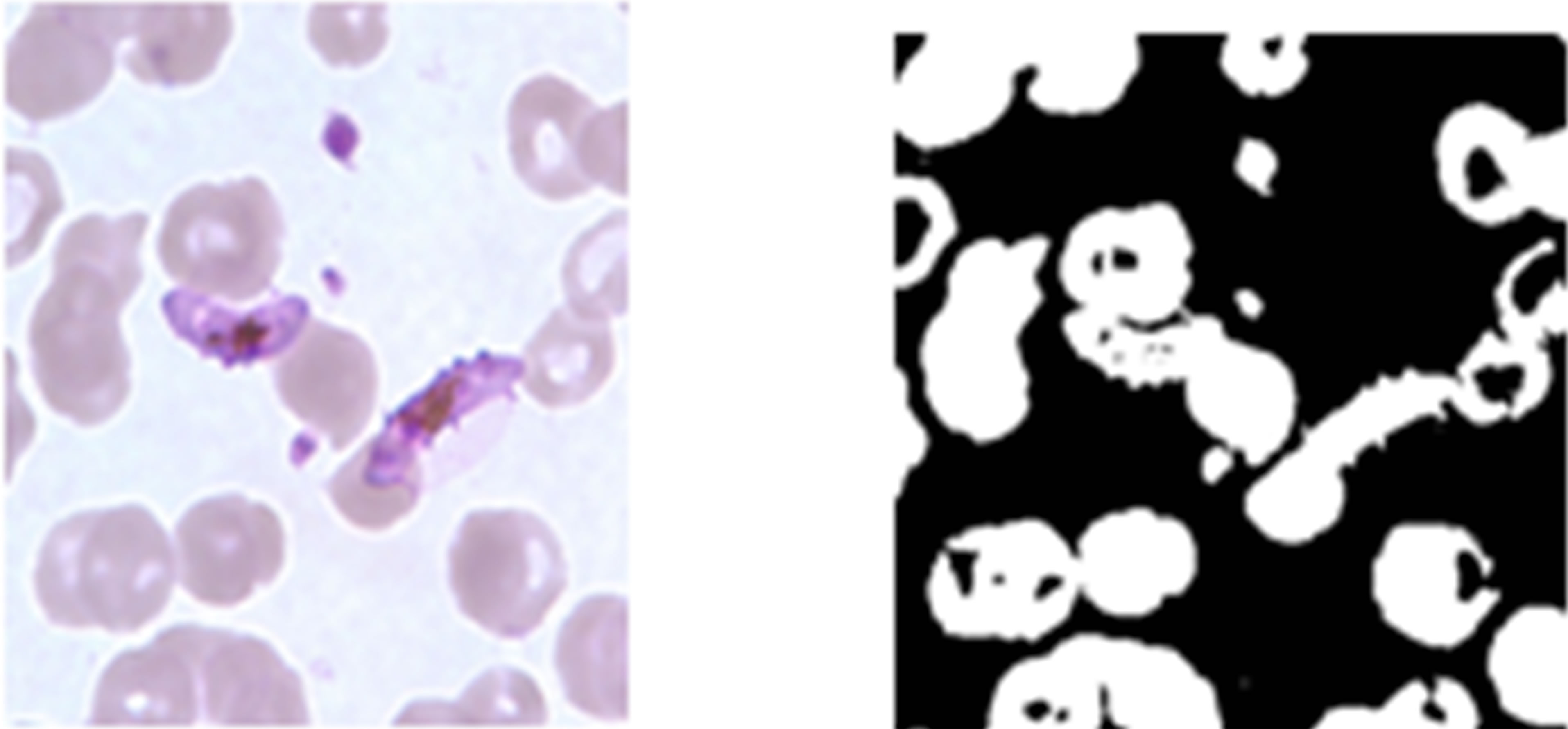 Detection of plasmodium parasites from images of thin blood smears