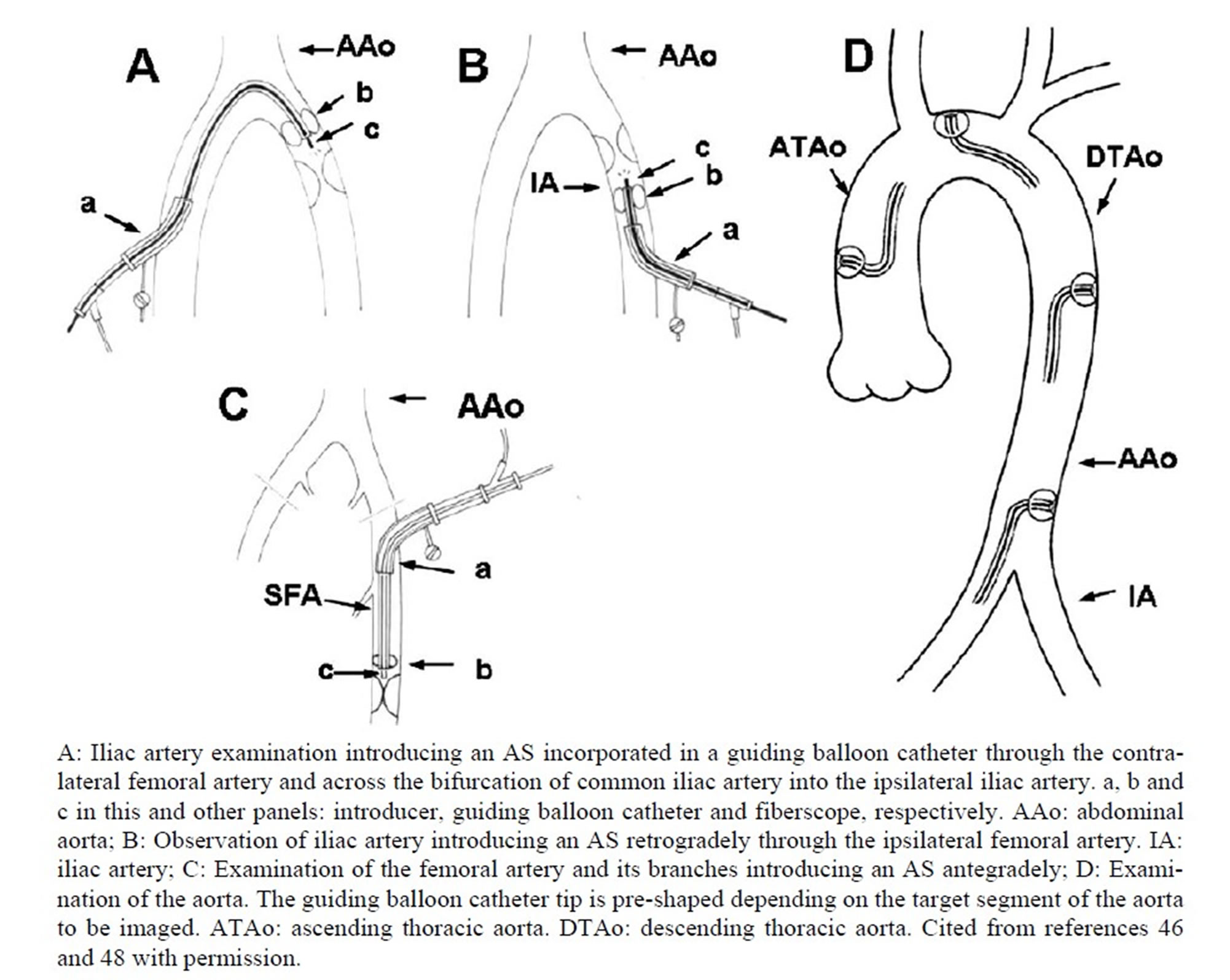 Advances in Angioscopic Imaging of Vascular Disease