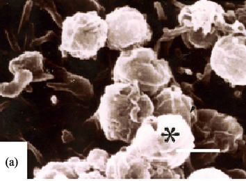 Coccoid Helicobacter pylori Can Directly Adhere and Invade in Agminated ...