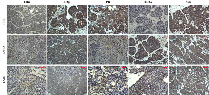 The MMTV-PyVT Transgenic Mouse as a Multistage Model for Mammary ...