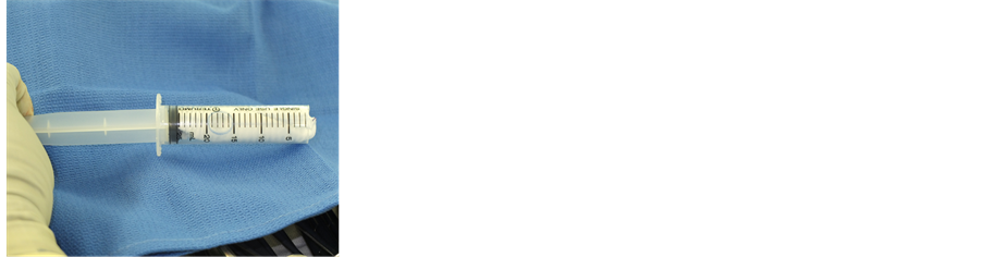 A Modified Branched Graft Inversion Technique Employing a Syringe ...