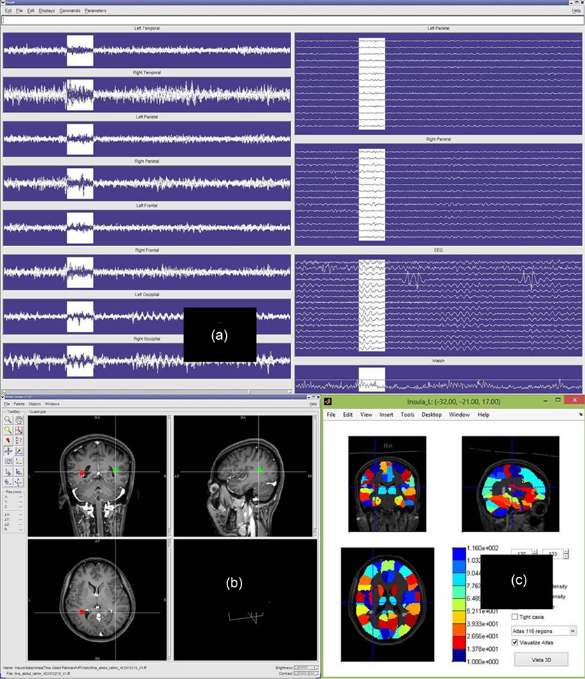 Principles, Anatomical Origin and Applications of Brainwaves: A Review ...