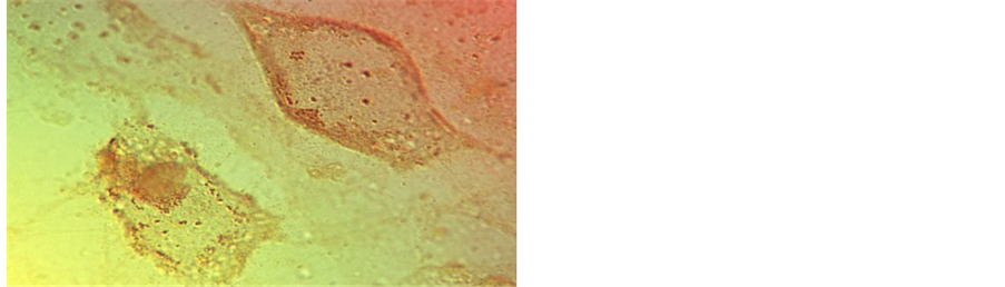 Mineral Fabrication and Golgi Apparatus Activity in the Mouse Calvarium