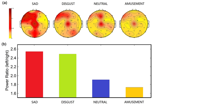 Individual Classification Of Emotions Using Eeg