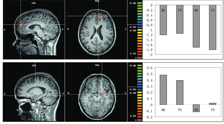 Gender Differences in Neural Mechanisms Underlying Moral Judgment of ...