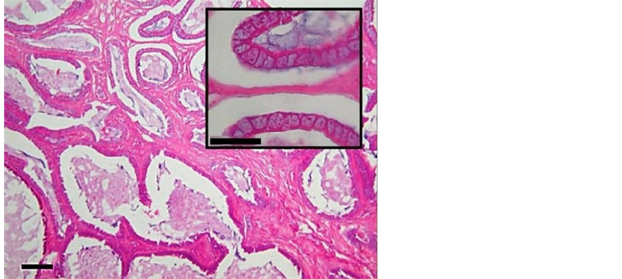 Mandibular Fibrosarcoma and Bile Duct Adenoma in a Pet Rabbit ...