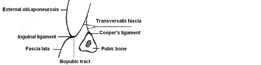 The Femoral Hernia: Some Necessary Additions