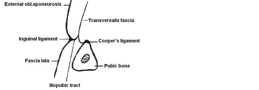 The Femoral Hernia: Some Necessary Additions