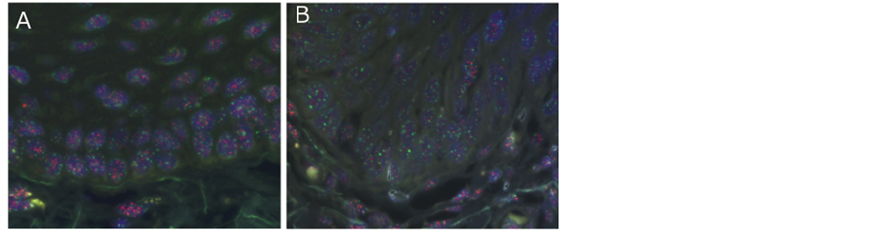 Determination of Telomere Length by the Quantitative Fluorescence in ...