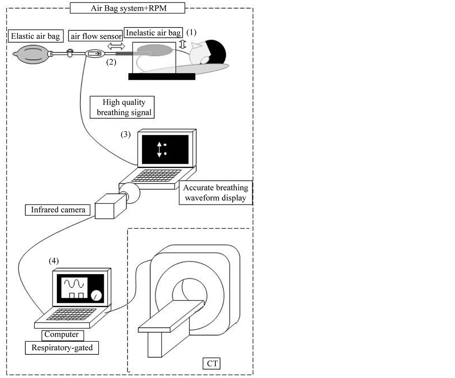 Lung Stereotactic Body Radiotherapy Using an Abdominal Compression ...