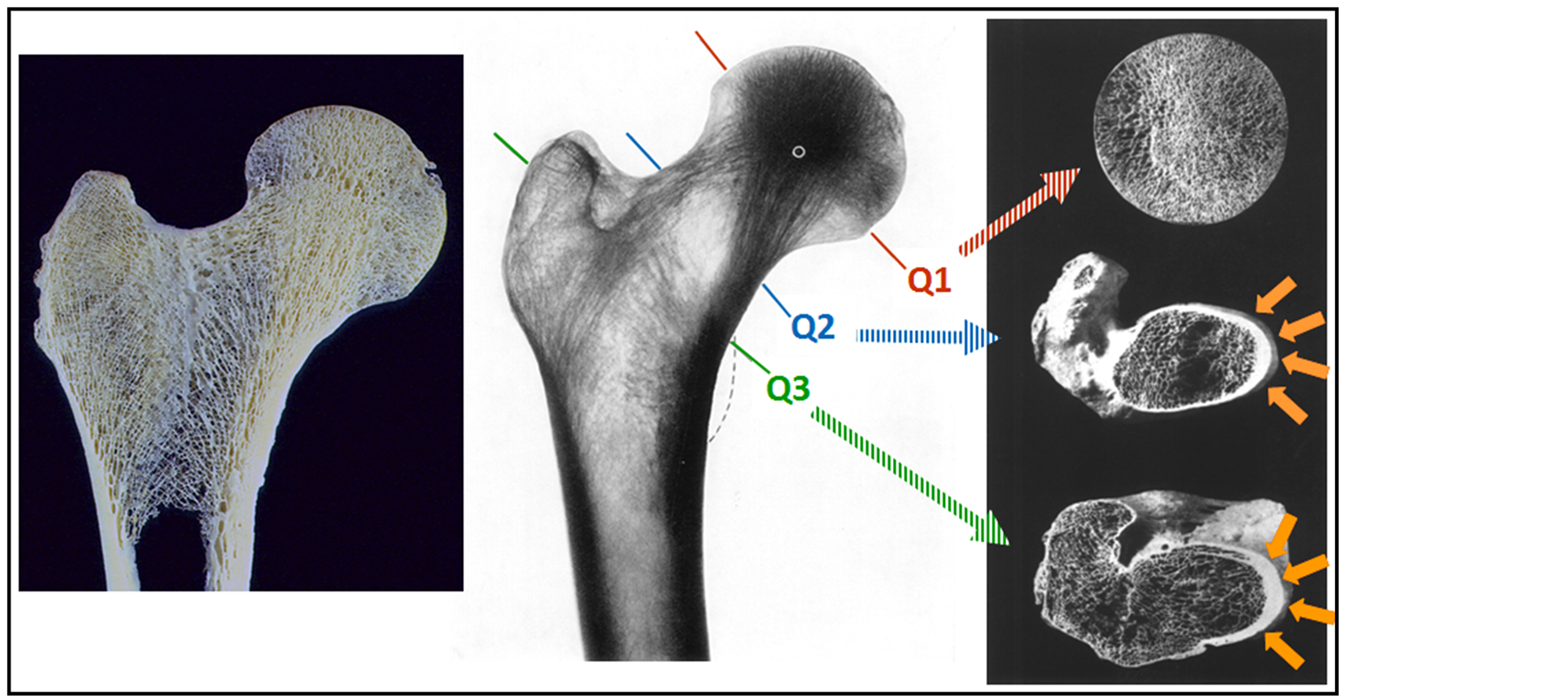 Tissue Sparing Surgery and Its Relevance within Hip Prosthesis