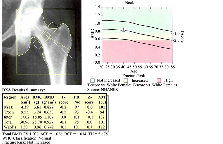 Optimization of Physical Activity as a Countermeasure of Bone Loss: A 5 ...