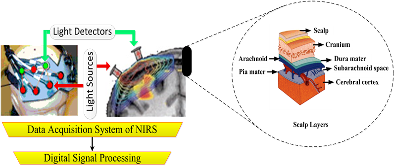 Brain Function Diagnosis Enhanced Using Denoised fNIRS Raw Signals