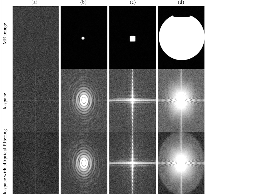 Short Report: A Sponge Phantom Provides a Homogeneous k-Space Pattern ...