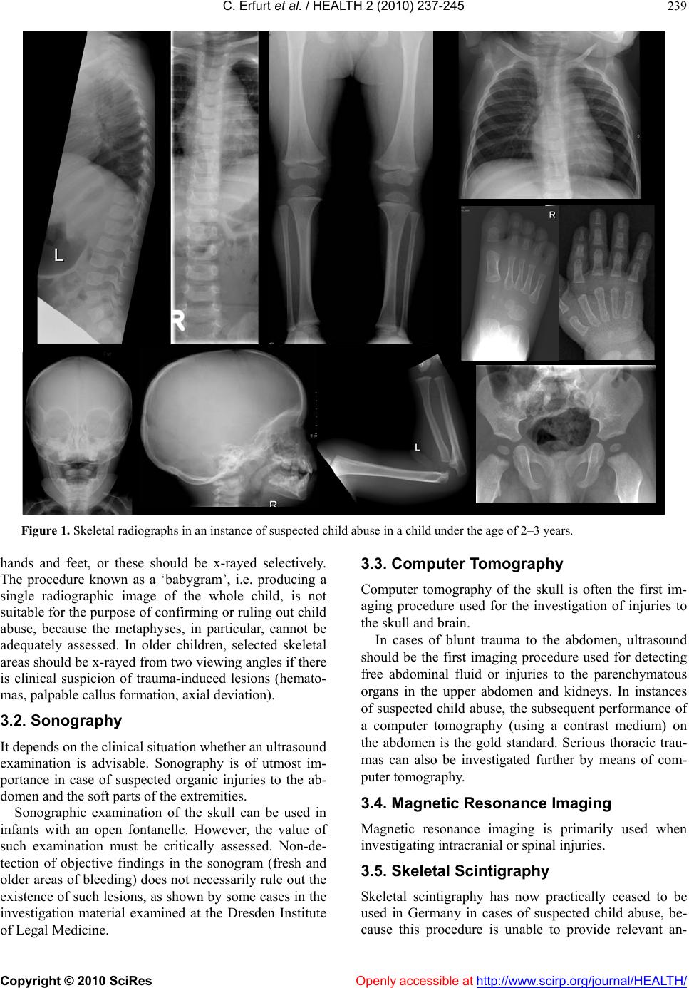 Pediatric radiological diagnostic procedures in cases of suspected ...