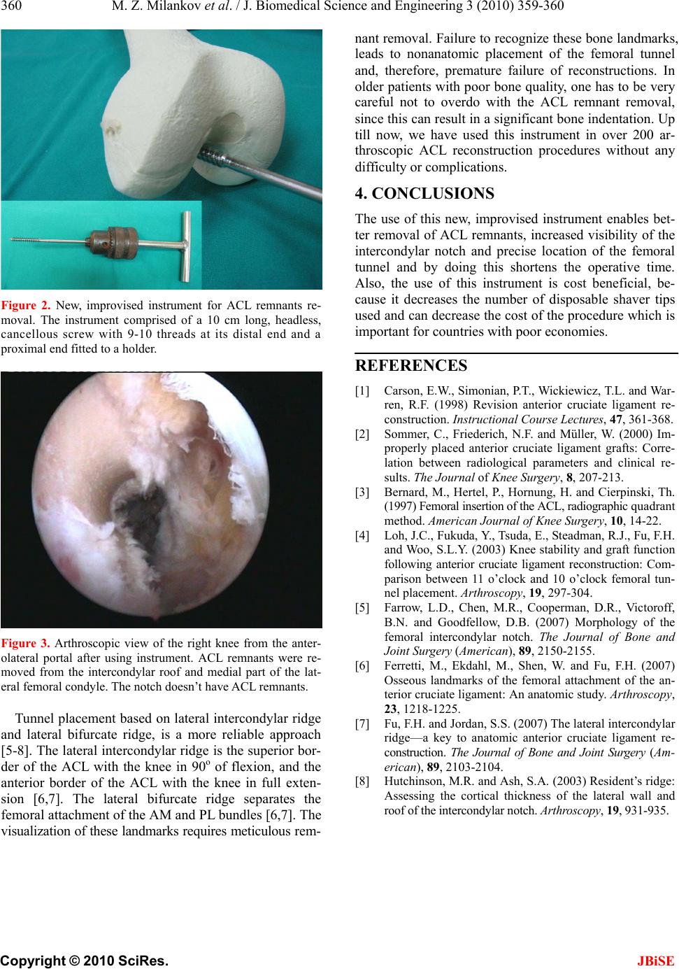 Femoral notch cleaning in anterior cruciate ligament reconstruction: a ...