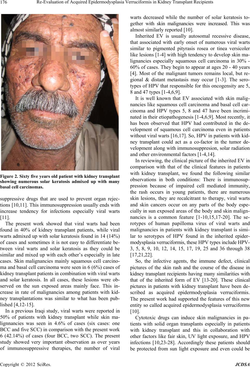 Epidermodysplasia Verruciformis Before And After