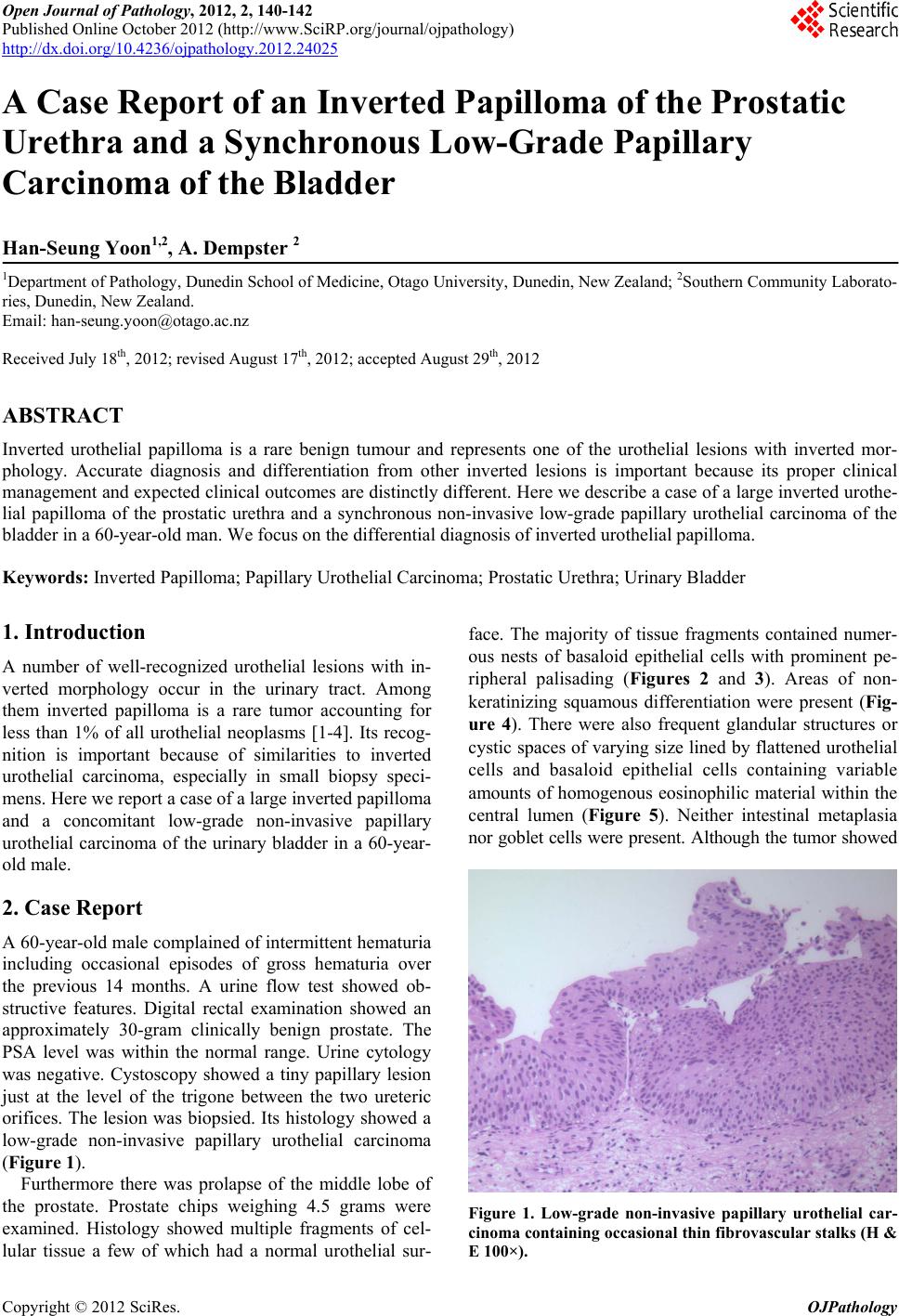 Inverted Papilloma Bladder