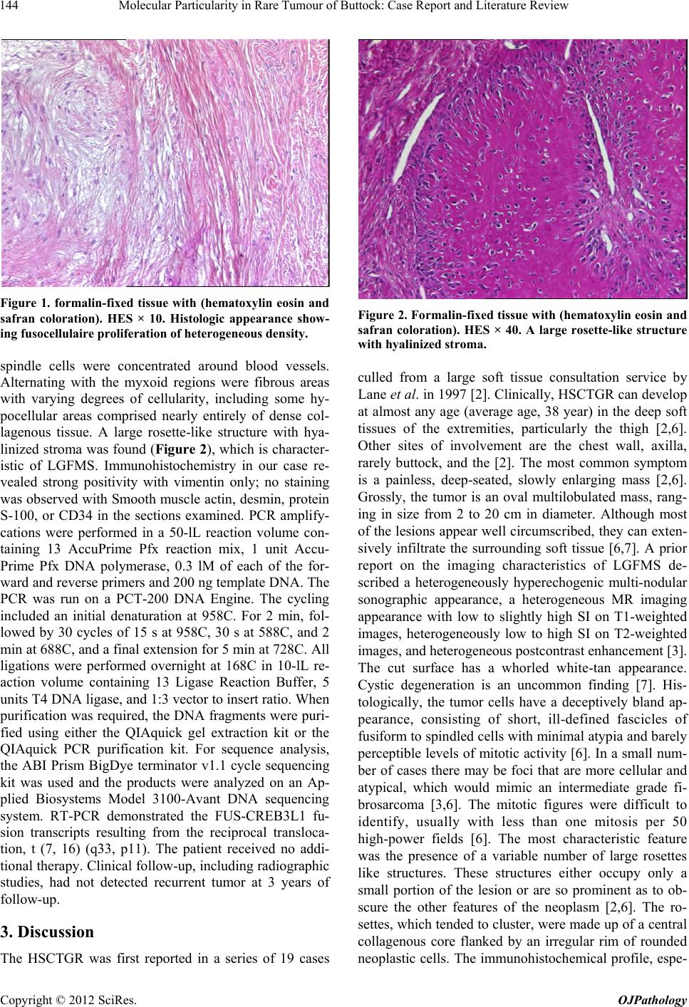 Molecular Particularity in Rare Tumour of Buttock: Case Report and ...
